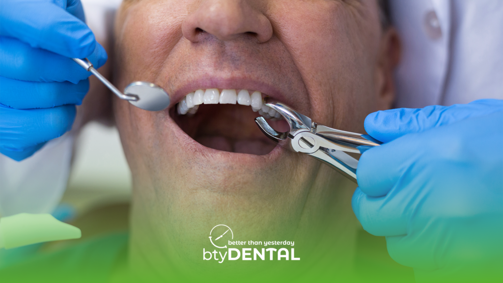 When to Get a Tooth Extraction: Everything You Need to Know